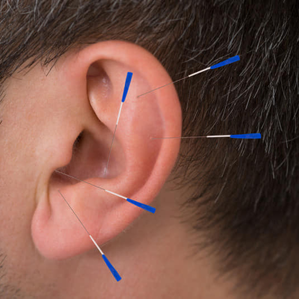 Healing Touch Acupuncture & Herbal Medicine in Beloit WI